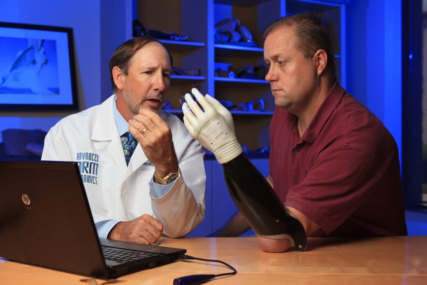 Amputation Levels | Arm Dynamics